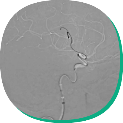 About Us | Scientia Vascular